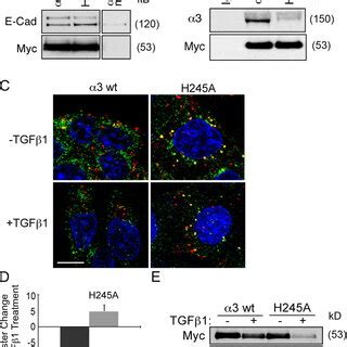 Turnover Of E Cadherin And TGF R1 Complexes Requires 3 1
