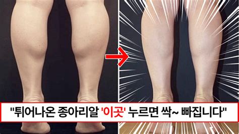 “꾹~ 눌러만 주세요” 종아리 부종 근육 뭉침 혈액순환 혈자리 자극하여 뭉친 알 빼는 방법 뉴스위크