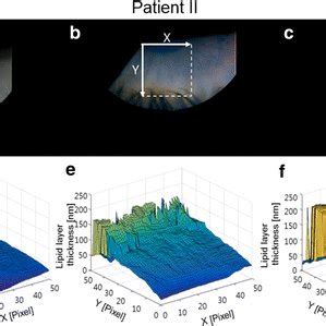 Spatial Visualization Of Lipid Layer Thickness Distribution Ac The Download Scientific
