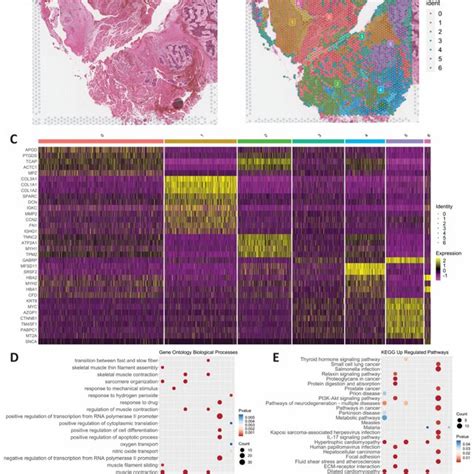 Spatial Transcriptomics Elucidates Lgacc And Surrounding Tissue Download Scientific Diagram