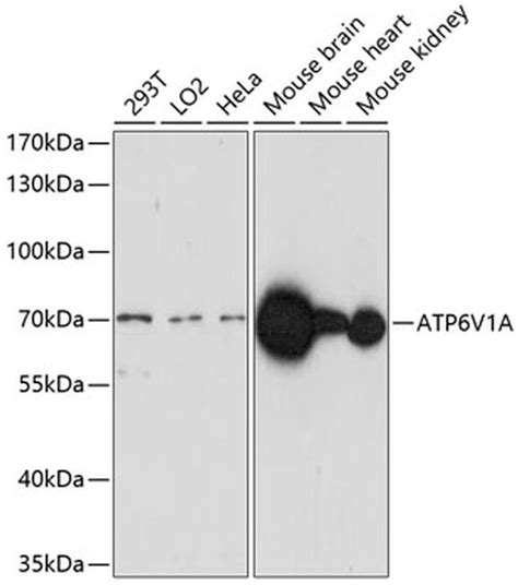 V Atpase A Antibody Pa5 89994