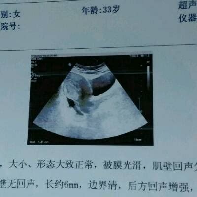 宫颈多发纳囊图片 最严重的宫颈纳囊图片 随意云