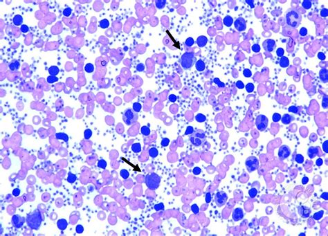 Cerebriform Nuclei