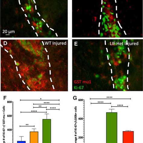 Svz Astrocyte Progenitor Cell Proliferation Is Depressed In The Lif Het Download Scientific