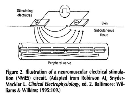 Neuromuscular Electrical Stimulation Pptx