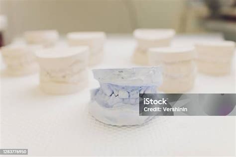 인간의 턱의 치과 주조 석고 모델 비뚤어진 치아와 말단 물린 중괄호로 치료하기 전에 촬영했습니다 회색 배경에 기술 샷 0명에