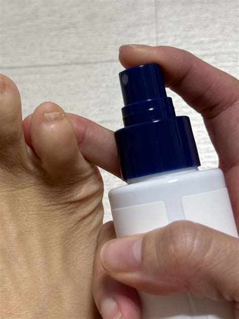 바르지오 네일라카 약국 발톱무좀약 추천 사용팁 네이버 블로그