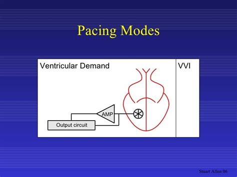 Pacemaker Overview