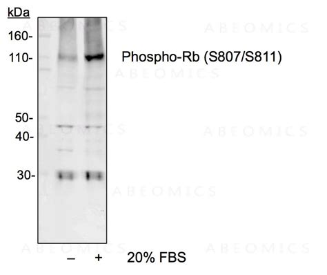 Phospho Rb Ser807811 Clone D9 Rabbit Mab Pd L1 Elisa Kit Dnmt1