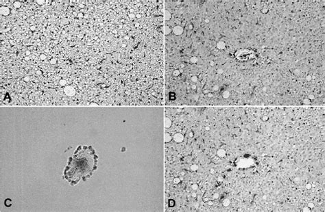 Figure 1 From Quantitative Molecular Analysis Of Laser Microdissected