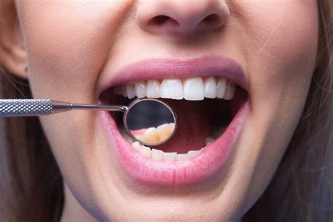 Premium Photo Teeth Dentist Mouth Mirror Closeup Examination Of Teeth