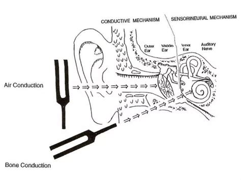 Tuning Fork Test Pptx