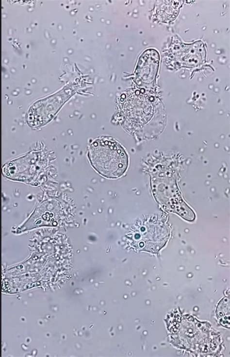 Investigaciones Científicas Y Servicios De Alta Tecnología Aip Macrófagos Humanos Fagocitando