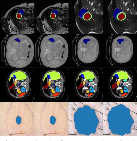The Fully Convolutional Transformer For Medical Image Segmentation