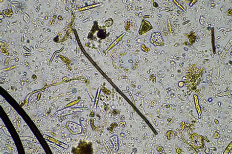 Fungal And Fungi Hyphae Under The Microscope In The Soil And Compost