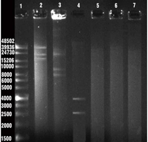 Plasmid Profile For E Faecalis S Aureus And Bacillus Sp Lane 1 50 Download Scientific