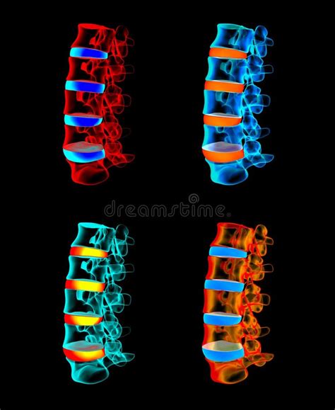The Structure Of The Spinal Cord Infographics Vector Illustration On