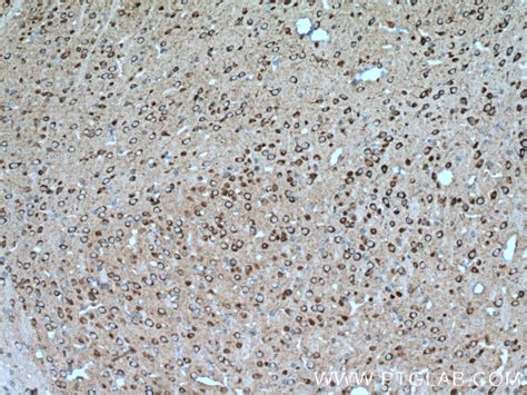 Drd2 Antibody 22022 1 Ap Proteintech