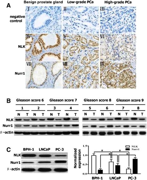 Nemo Like Kinase As A Negative Regulator Of Nuclear Receptor Nurr1 Gene