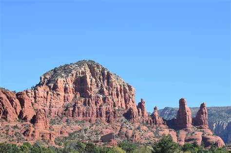 The Vulva Gallery What Is A Vaginal Yeast Infection Vaginal