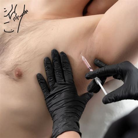 Hyperhidrosis Treatments At Cotswold Surgical Partners