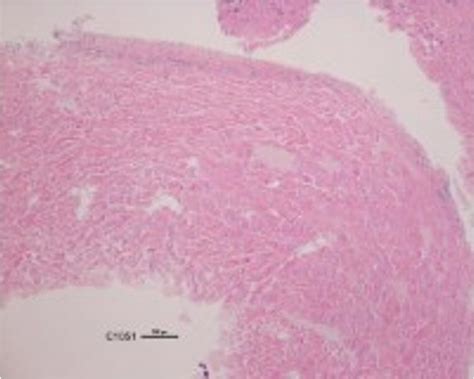 Histological Analysis Of Banked Strattice Download Scientific Diagram