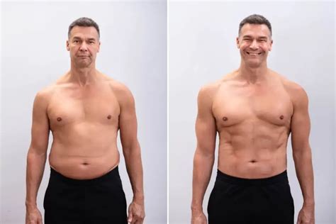How To Get Fat Transfer Results Without Surgery