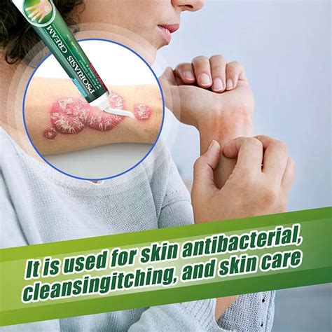 Psoriasis Cream Herbal Cream For Psoriasis Dermatitis Eczema And