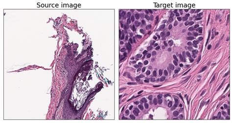 Preprocessing Hande Stain Normalization — Pathml 302 Documentation