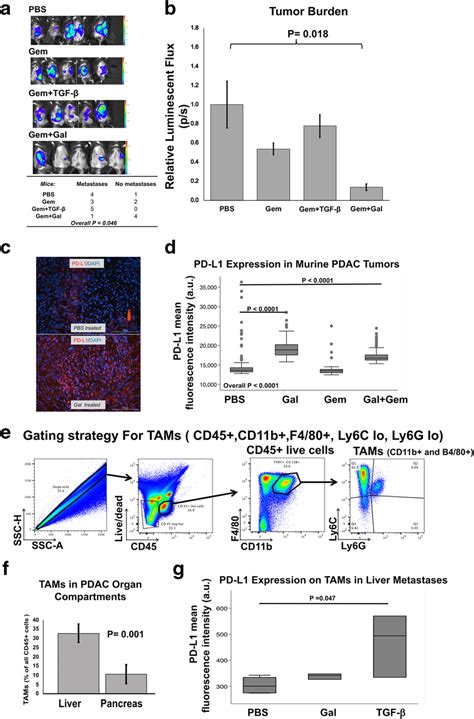 Gemcitabine Gem And Galunisertib Gal Reduce Pancreatic Cancer