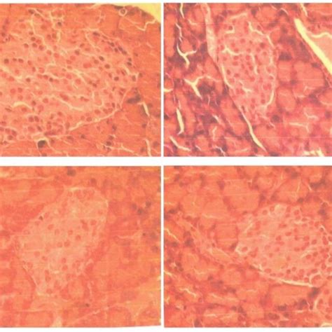 Photomicrograph Of The Pancreas Q Histology Of The Pancreas Showing