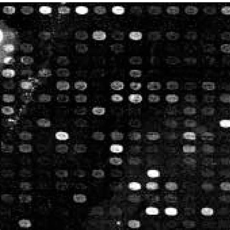 A Scanned Microarray Image And Four Example Spots Which Demonstrate Download Scientific