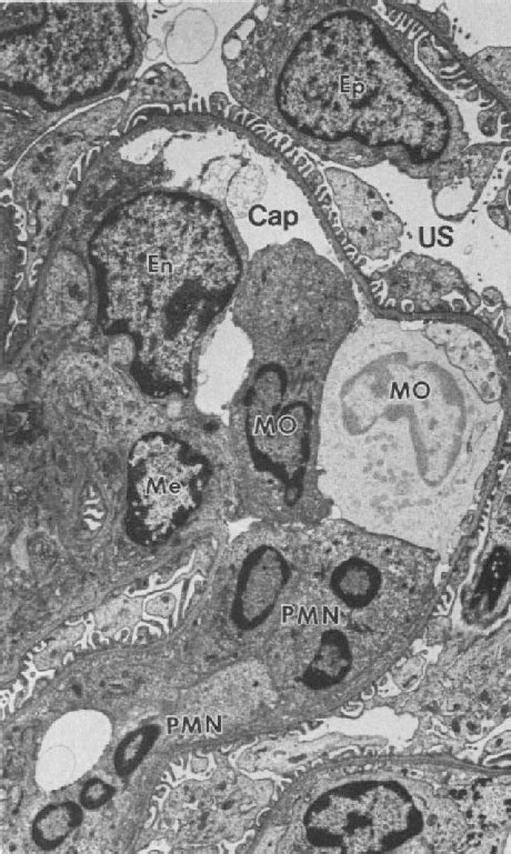 Electron Micrograph Of Portion Of The Glomerulus From A Presensitized