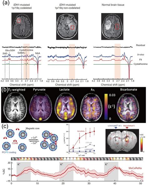 Metabolites Detection Using MRS MRI A Localized 1 H MRS Of An