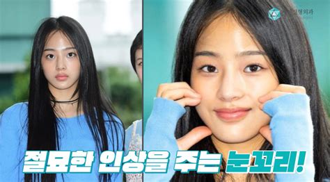 【k美容外科】new Jinsミンジの顔を分析！！ K美容外科k Beautyの中心