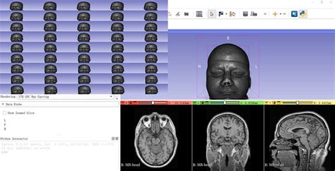How To Create A New 3d Window Independent Of The 3d Slicer Interface