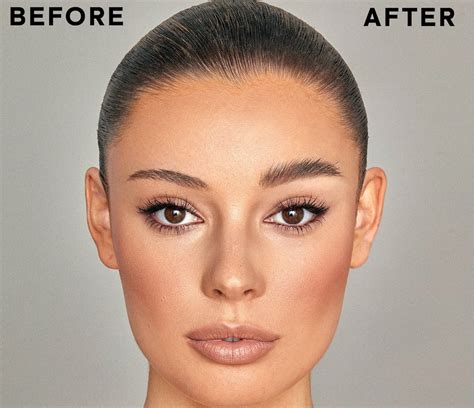 Body Contouring Imagine Radiant