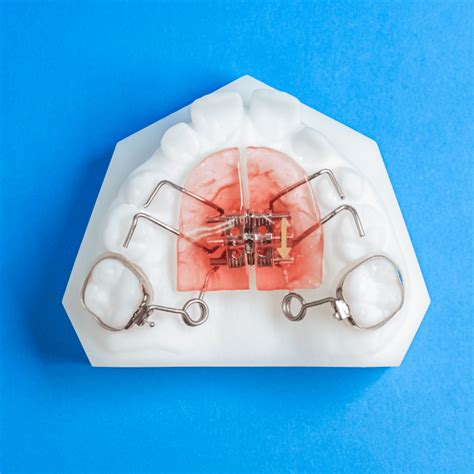 Pendex Specialty Appliances