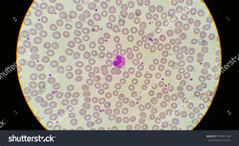 Eosinophils Microscope