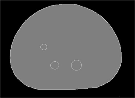 Schematic Of A Transaxial Slice Through The NEMA IEC Body Phantom With Download Scientific
