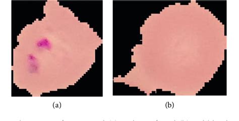 Figure From Deep Learning And Transfer Learning For Malaria Detection Semantic Scholar