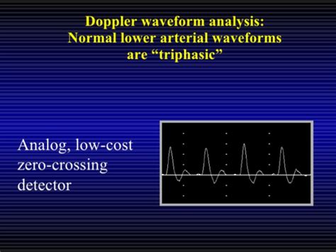 Chapter 1 Doppler Principles Flashcards Quizlet