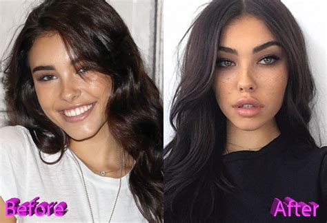 Madison Beer Plastic Surgery Work Of Mother Nature