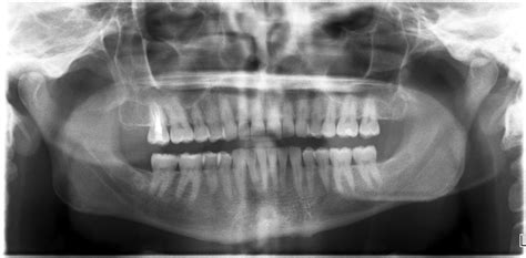 Panoramica Dentale Sanident