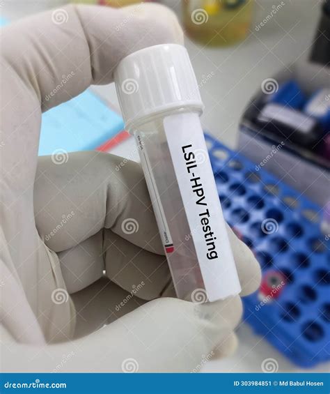 Vaginal Fluid Sample For Lsil Hpv Dna Test Stock Image Image Of