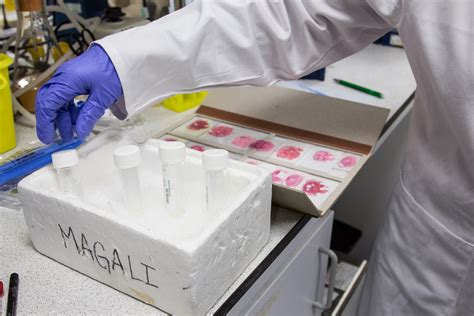The Spread Of Prostate Cancer Prostate Cancer Research