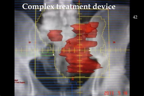 Ppt Section 8 Radiation Oncology Dosimetry Cpt Codes 77300 77370