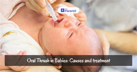 Oral Thrush In Babies Causes Symptoms Risk Factors And Treatment Options