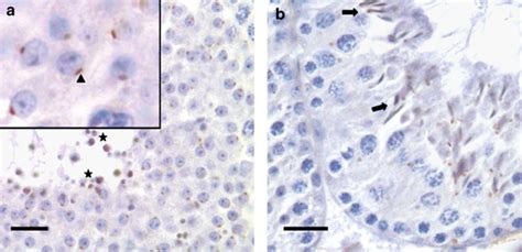 Cleaved Caspase 9 Immunohistological Labeling Of Normal Testis A