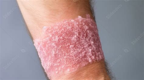 Fondos Codo Para Power Point Y Diapositivas Descarga Gratis Slidesdocs